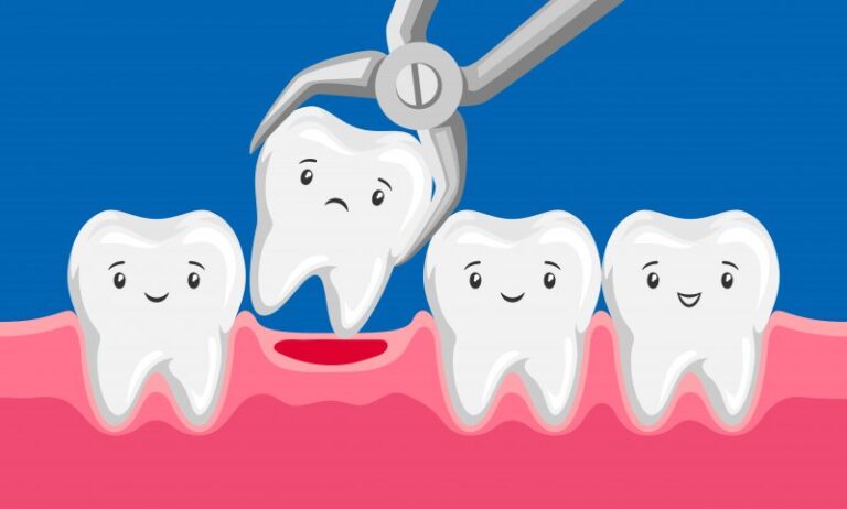 4 Reasons Your Child May Need Baby Teeth Extraction - Chicago Pediatric ...